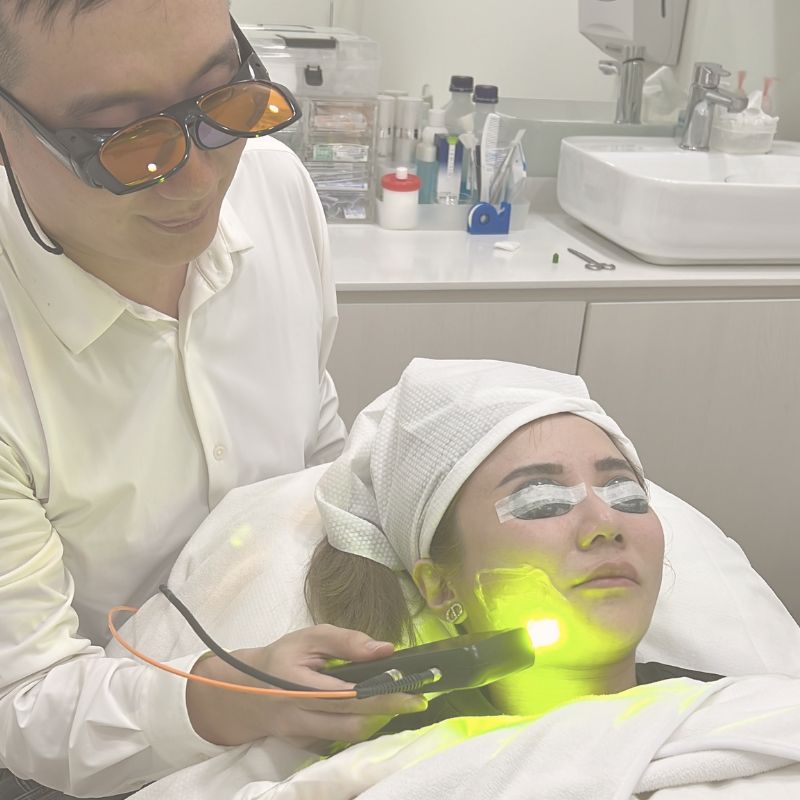 Pigmentation Laser - Swiss Clinic Singapore